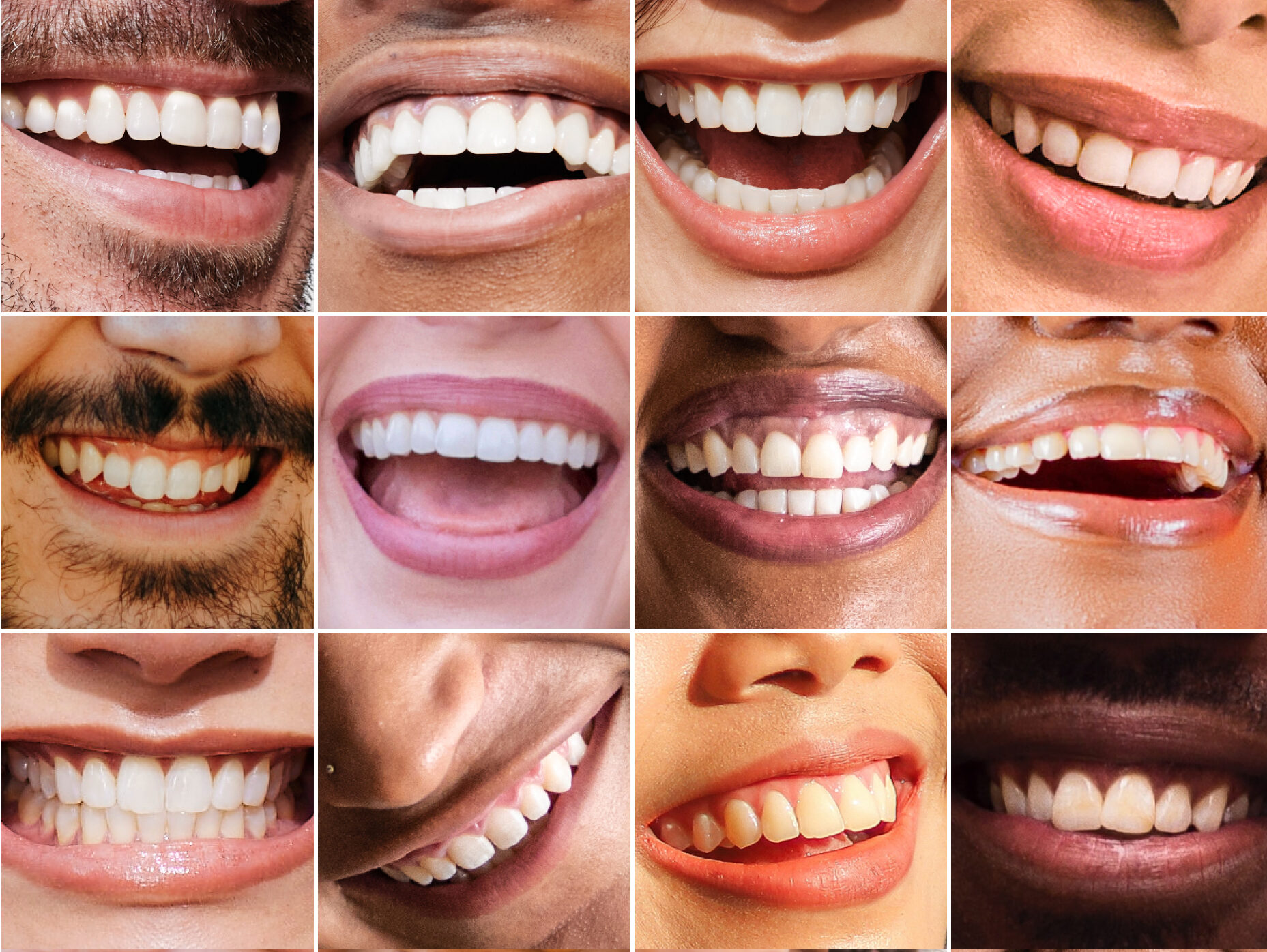 Candid Pro– Full Review - Dental & Mouth Pain - ItHurts